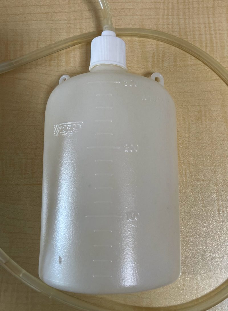 がんサバイバー：PTGBDのGボトルの身に着け方（胆管がん） | 薬剤師が教える健康術